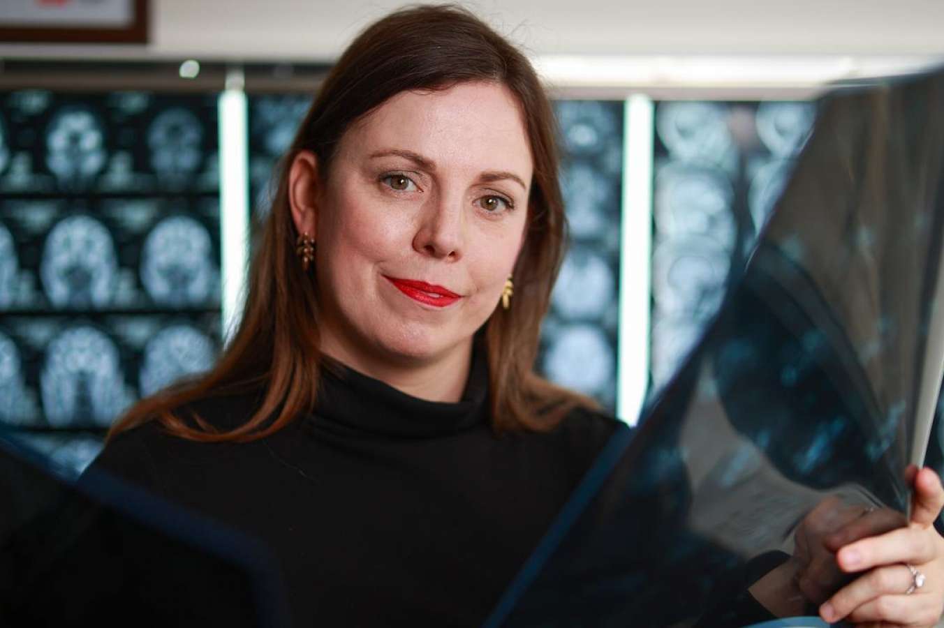 Landmark change: Experts call for standardised concussion protocols in ...